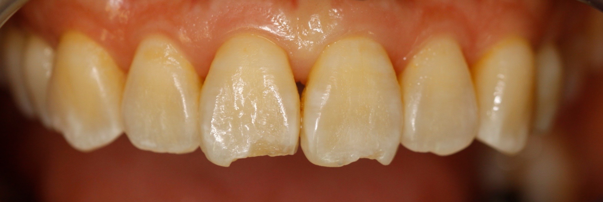 General Dentistry | S Dental Studio