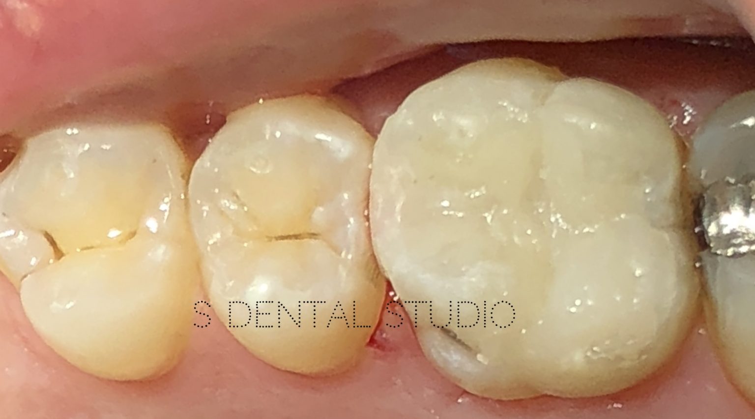 General Dentistry | S Dental Studio