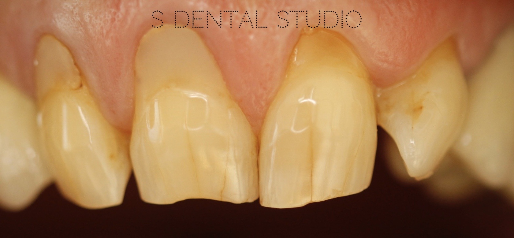 General Dentistry | S Dental Studio